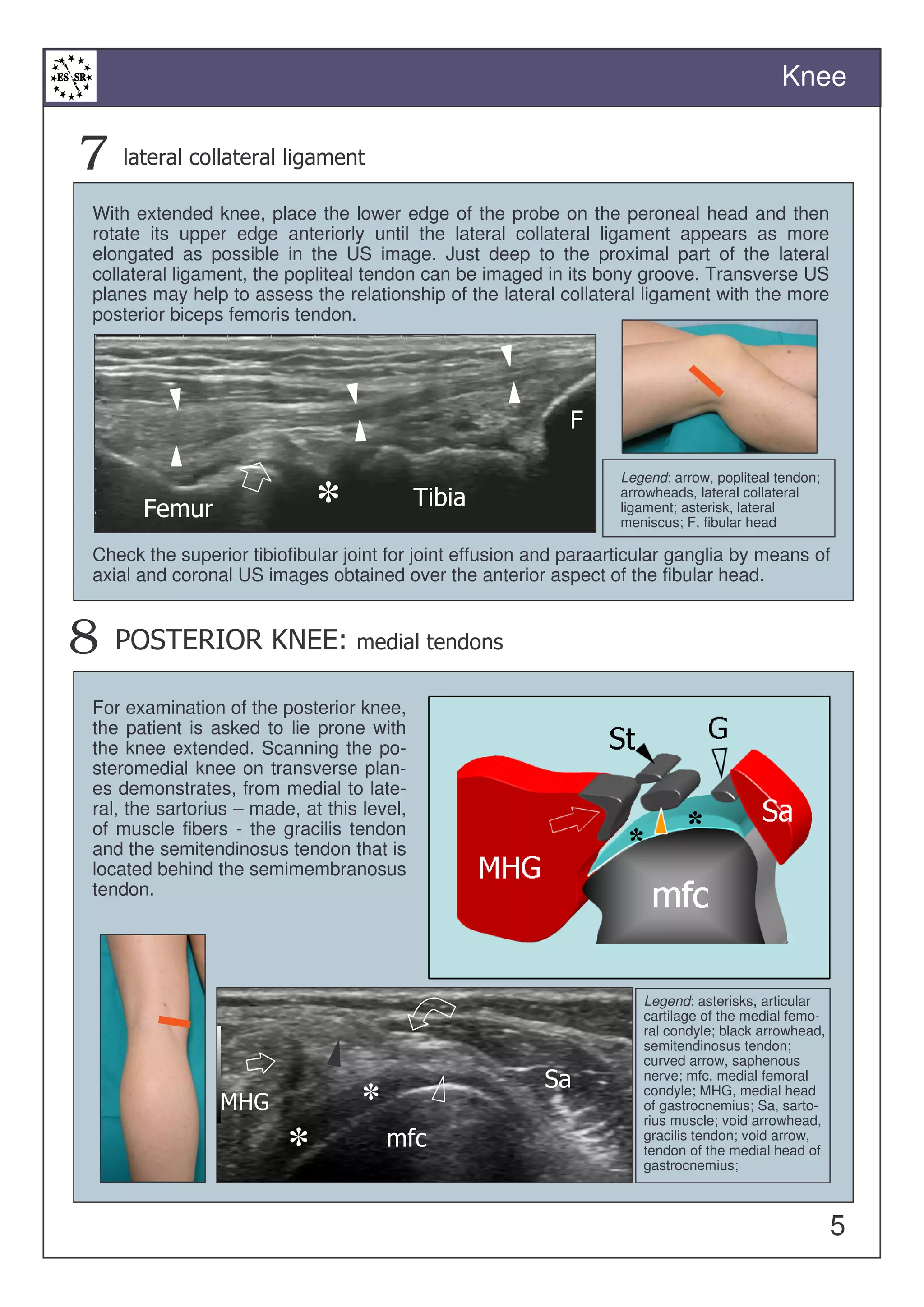 Knee | PDF