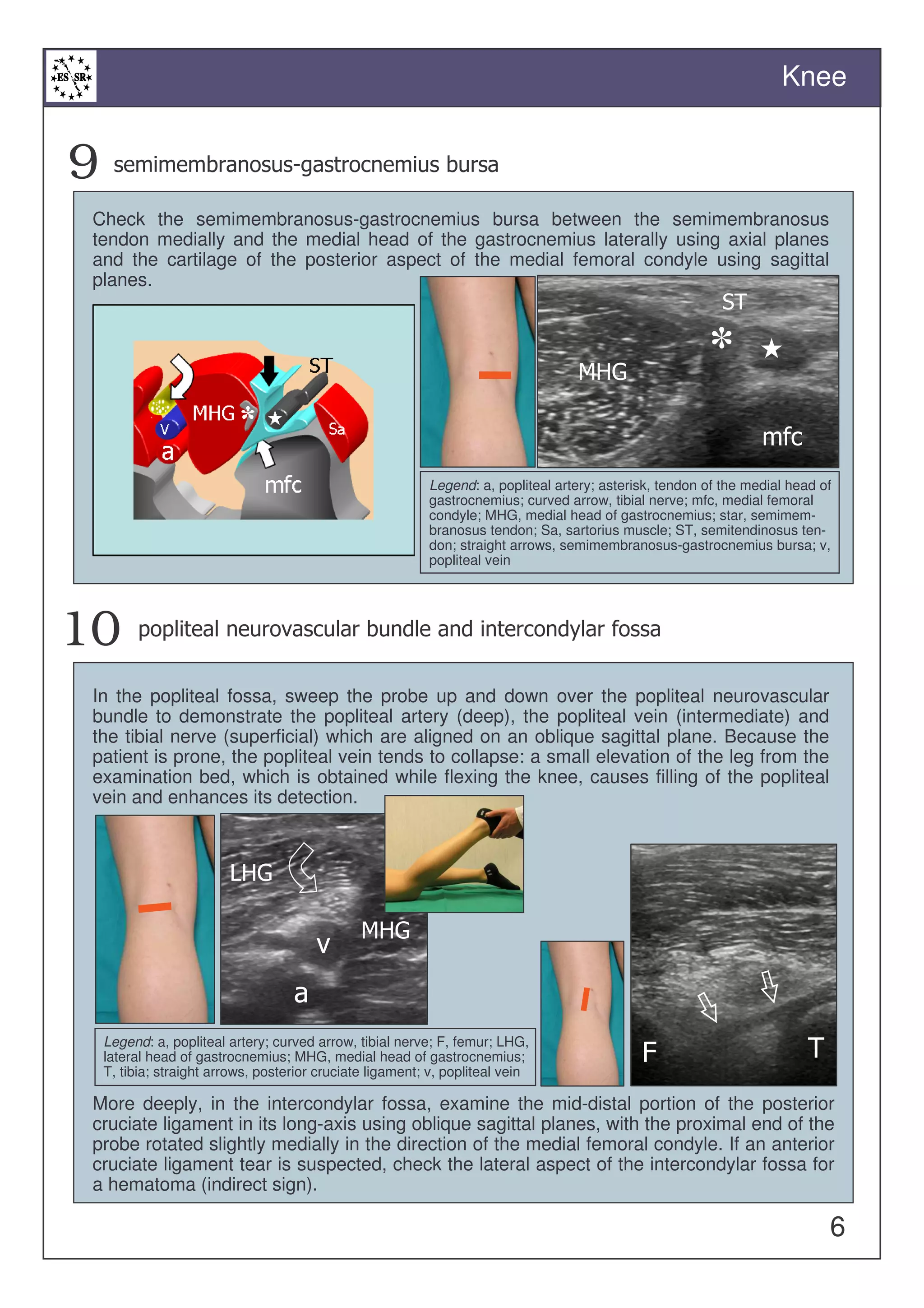 Knee | PDF