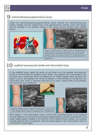 Knee | PDF | Death, Injury, or Military Conflict | Sensitive Topics