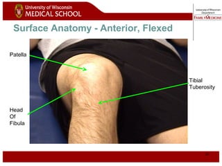 Tibial Tubercle Palpation