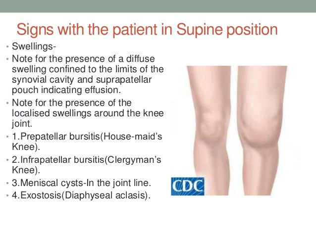 Anatomy and Examination of the Knee