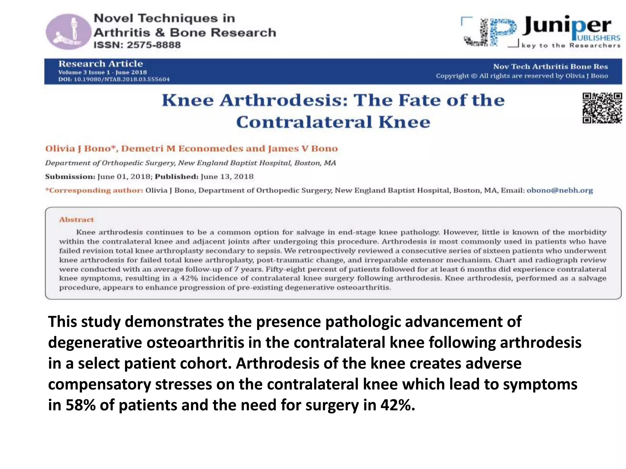Knee rthrodesis | PPTX