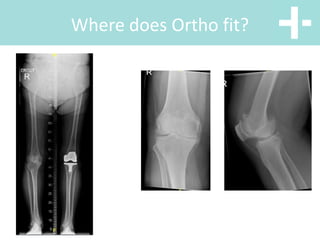 Common Knee Conditions and their management | PPTX