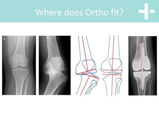 Common Knee Conditions and their management | PPTX