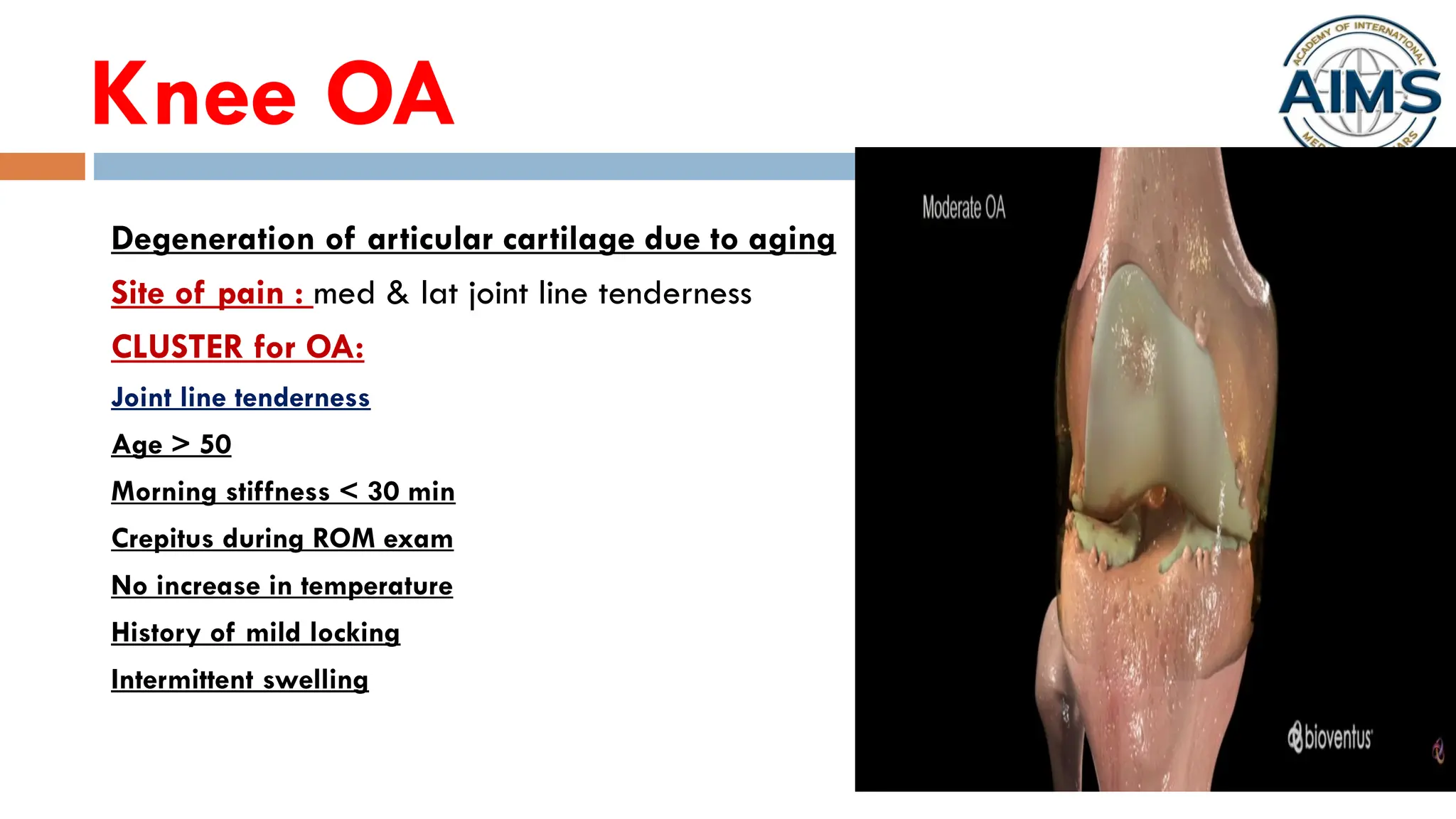 Simplified Mechanics of the knee joint and it’s stabilizing system | PDF