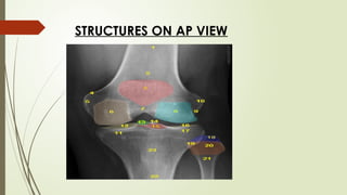 Anatomy of knee: presented by DR SHLIPI JHA MD RADIODIAGNOSIS | PPTX