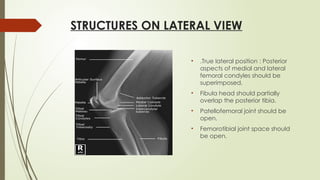 Anatomy of knee: presented by DR SHLIPI JHA MD RADIODIAGNOSIS | PPT