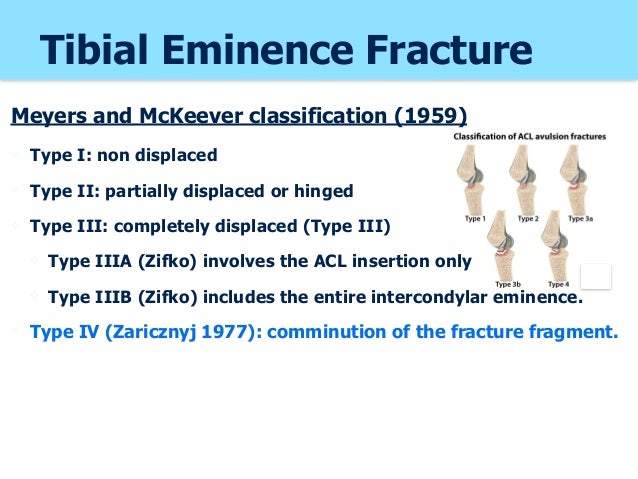 Knee Sports for PostGrad Orth Course 2017