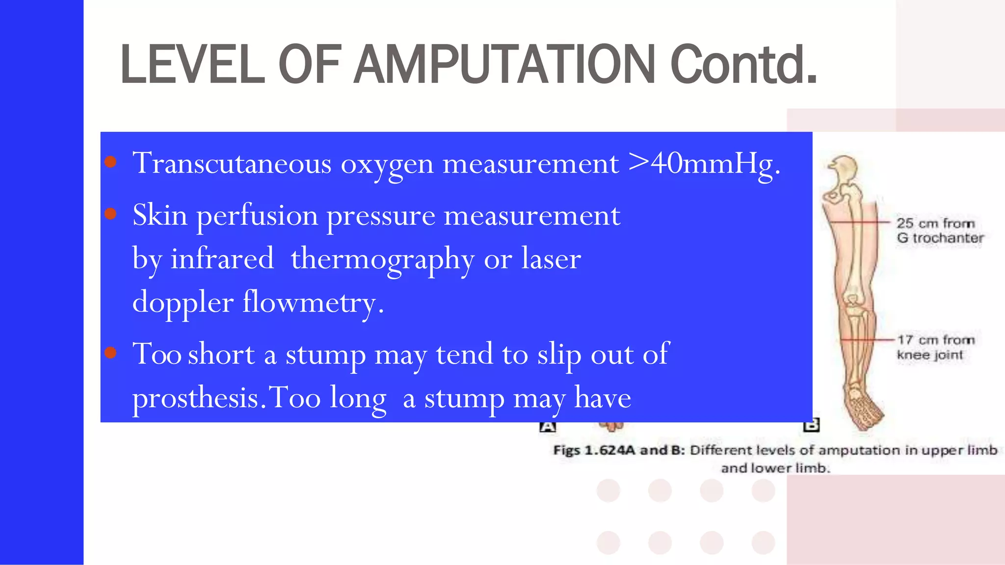 Knee Amputation.pptx