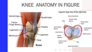 Knee Amputation.pptx