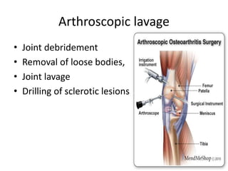 Knee anatomy,surgical approches & osteoarthritis of the knee | PPTX
