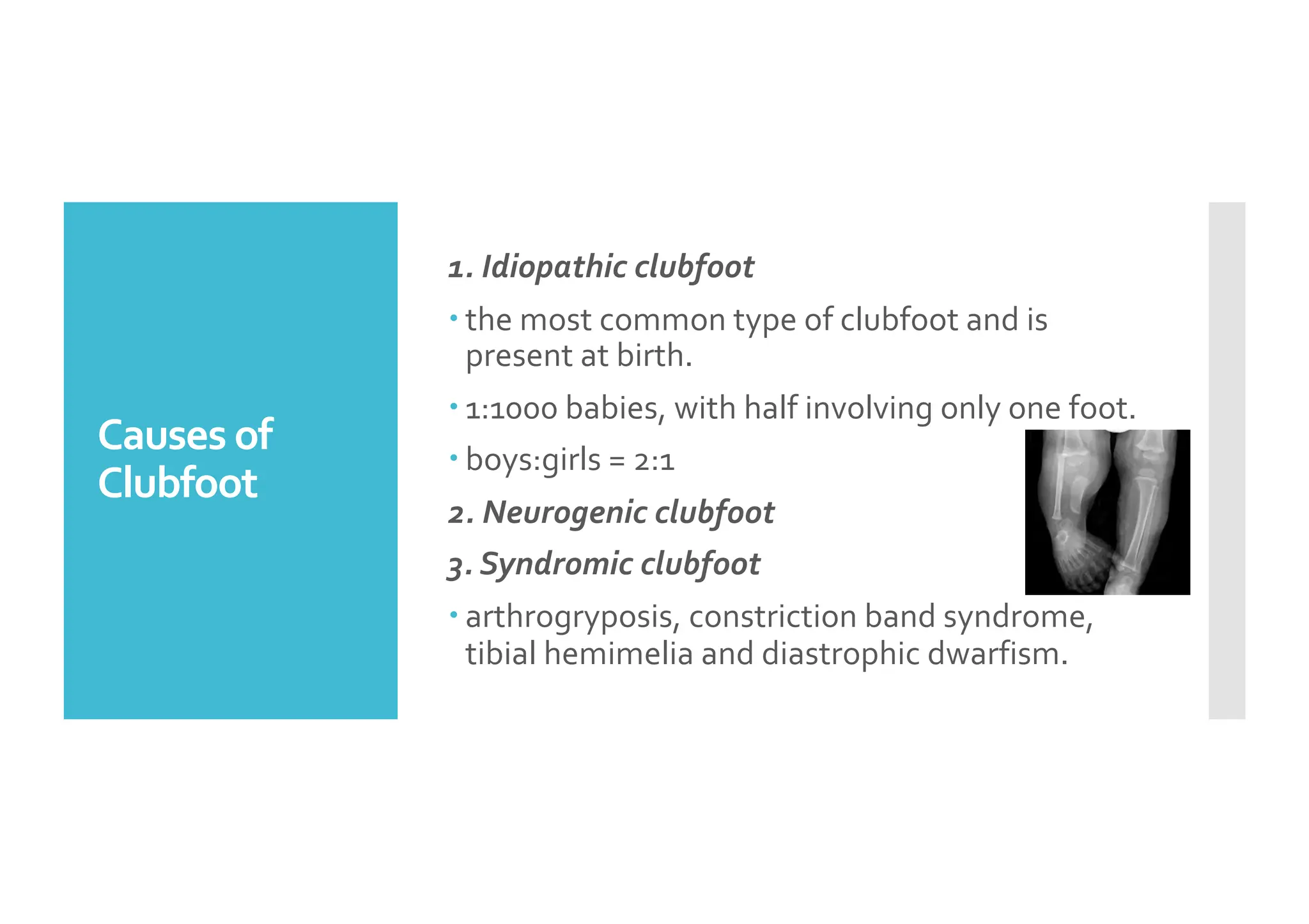 Knee and Foot Deformities in pediatrics.pdf | Death, Injury, or ...