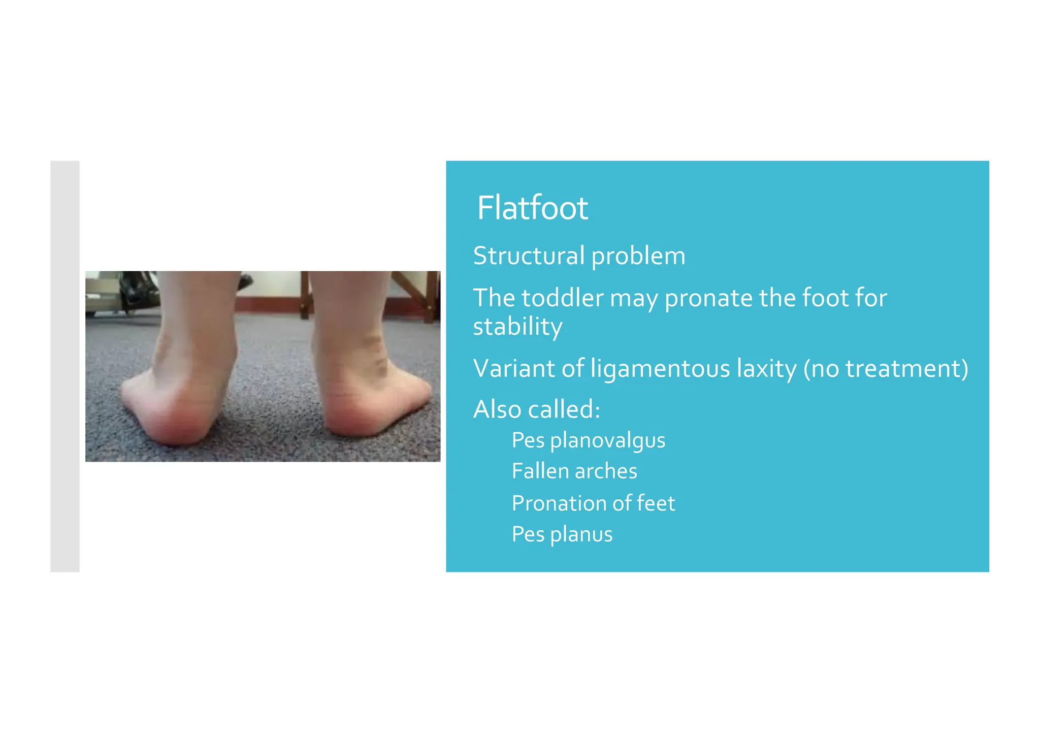 Knee and Foot Deformities in pediatrics.pdf