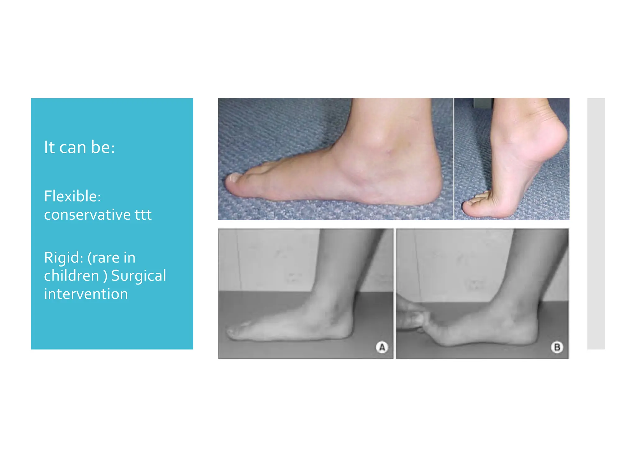 Knee and Foot Deformities in pediatrics.pdf