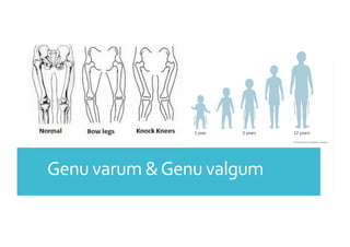 Knee and Foot Deformities in pediatrics.pdf