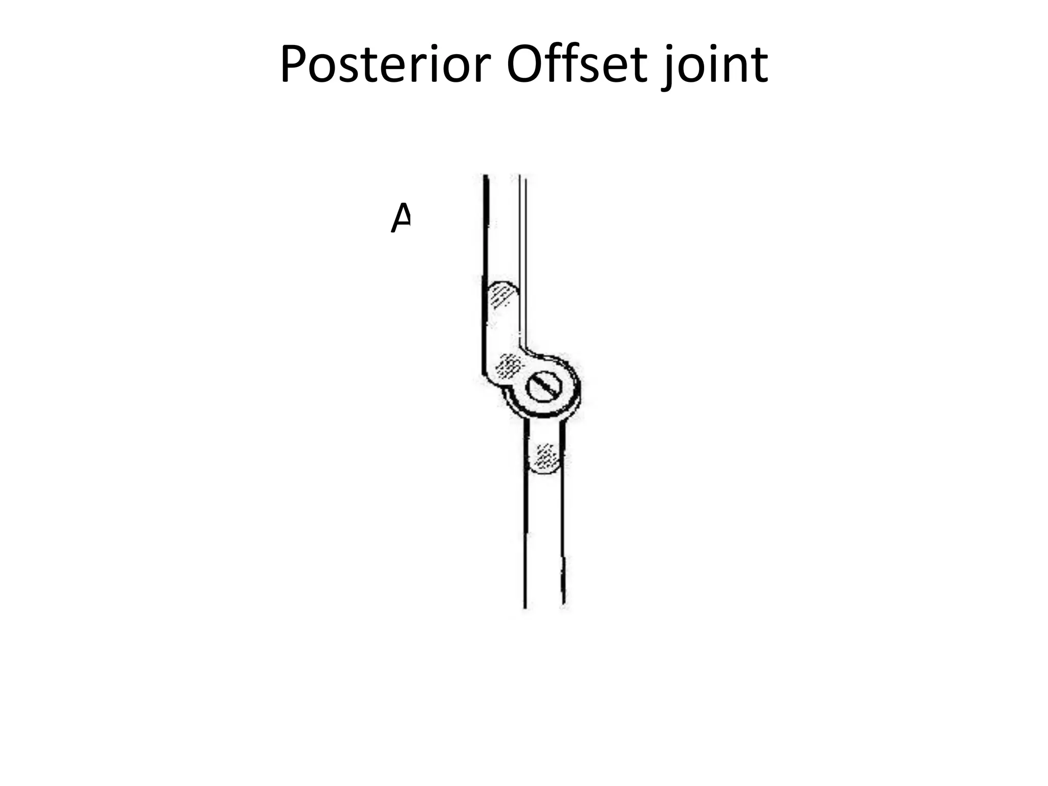 KNEE ANKLE FOOT ORTHOSIS.pptx