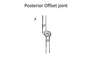 KNEE ANKLE FOOT ORTHOSIS.pptx