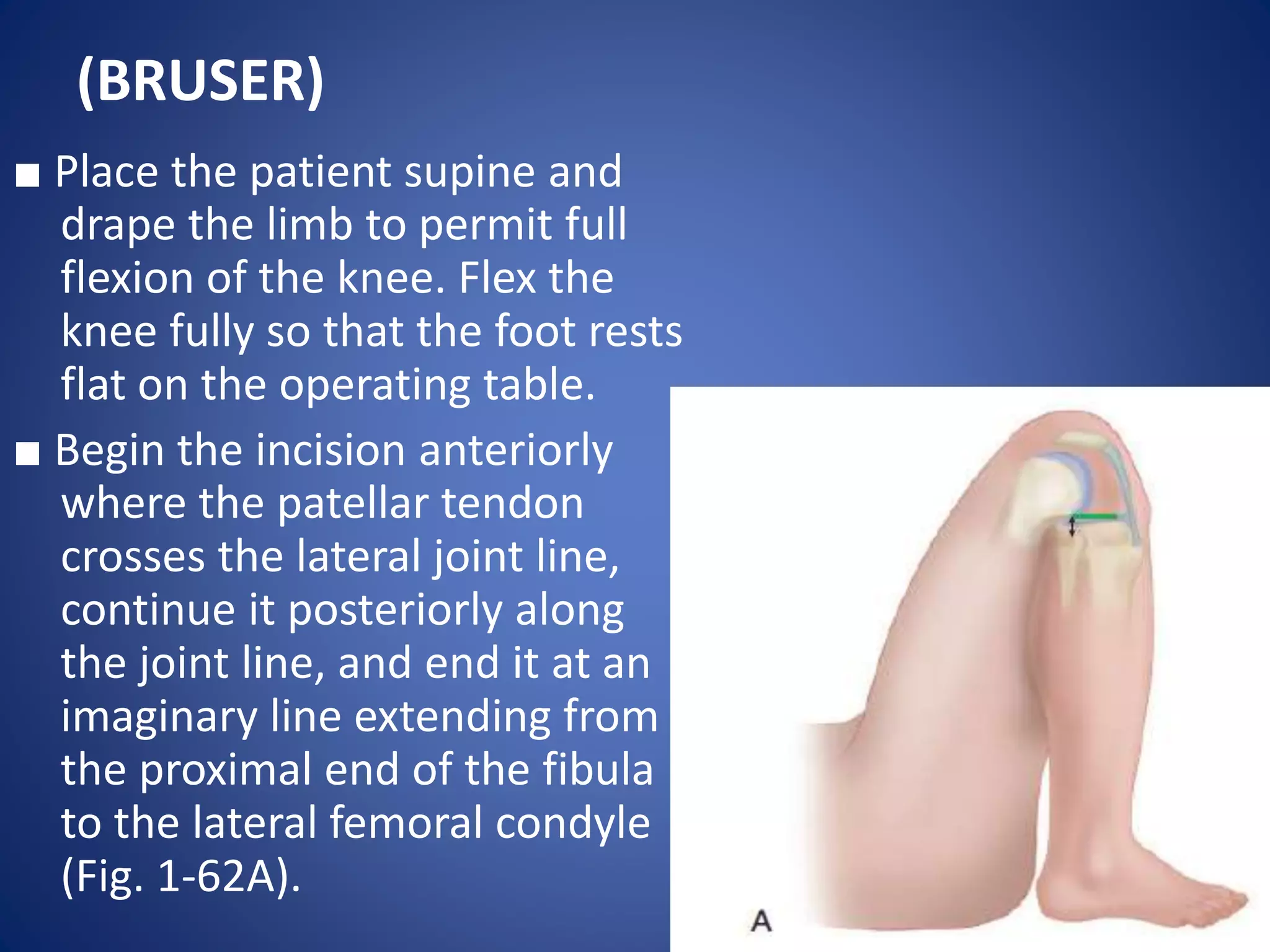 Surgical approaches to knee and ankle joints | PPTX