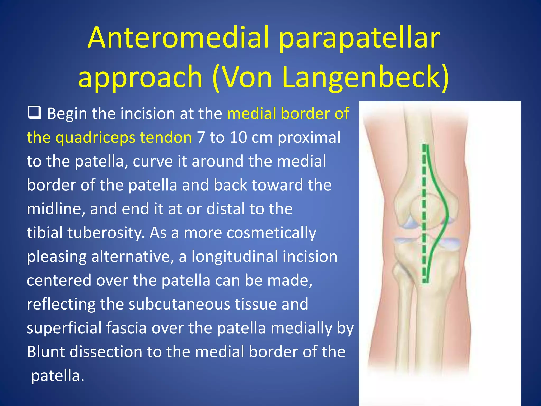 Surgical approaches to knee and ankle joints | PPTX