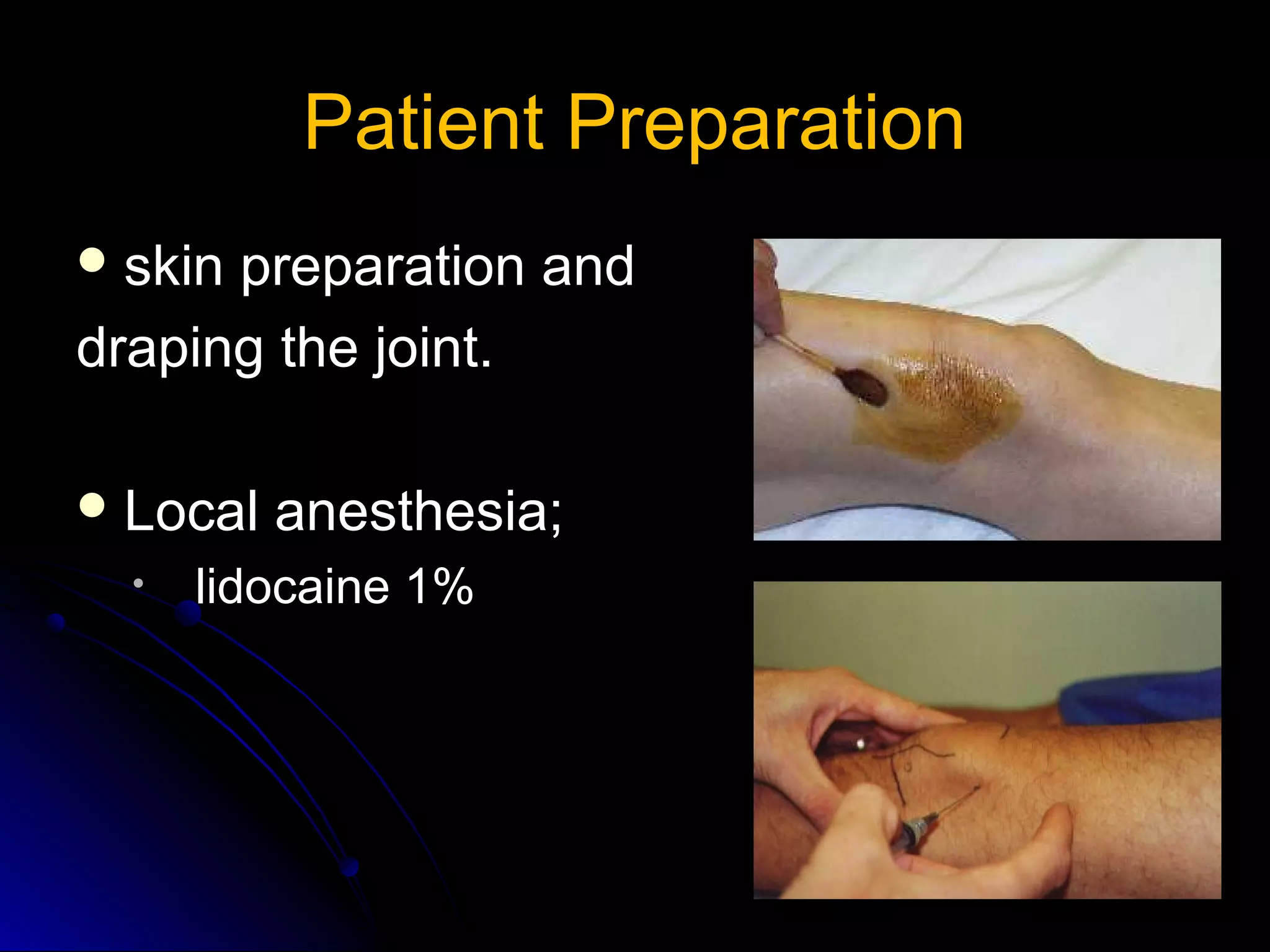 Knee arthrocentesis | PPT
