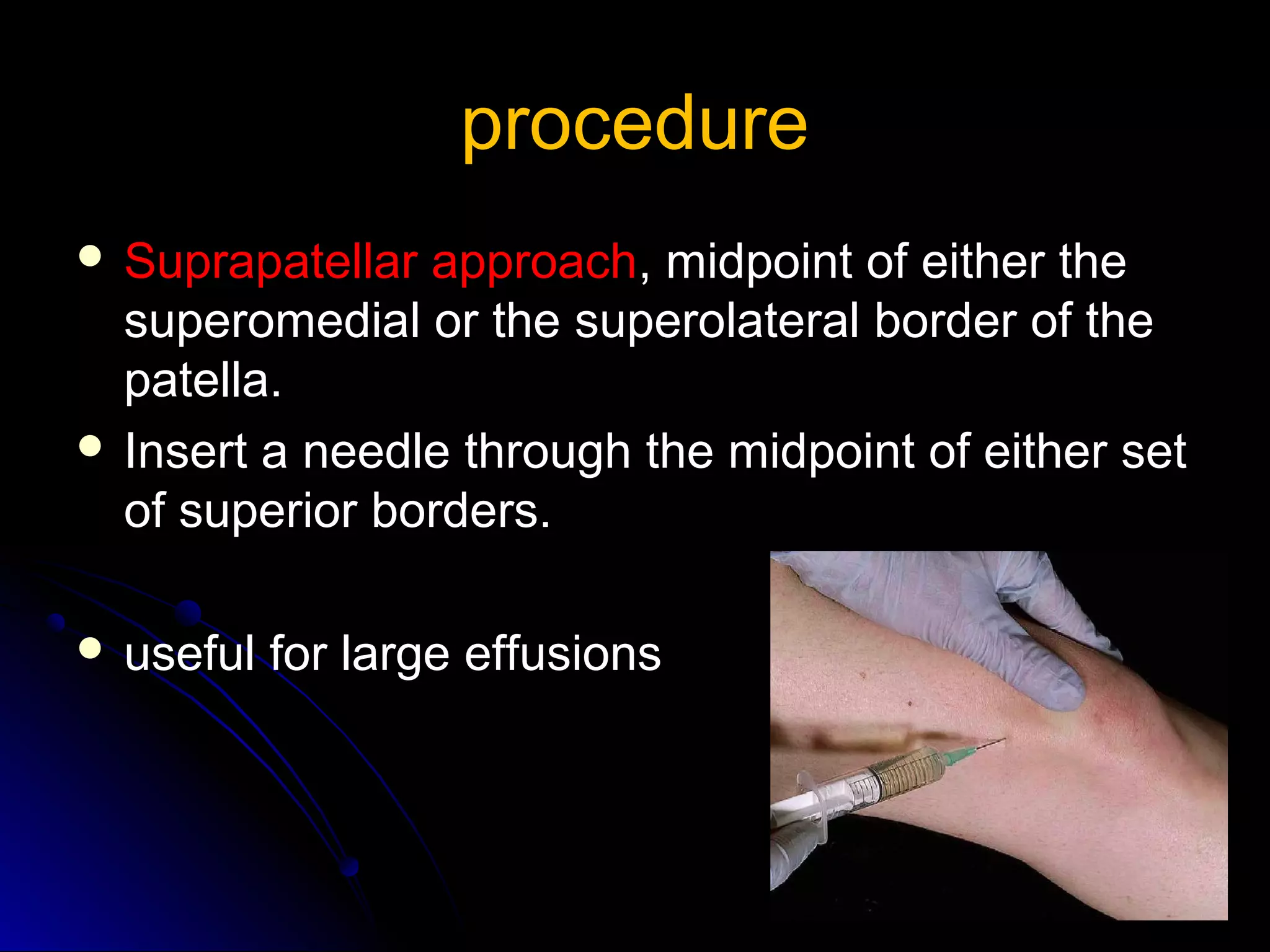 Knee arthrocentesis | PPT