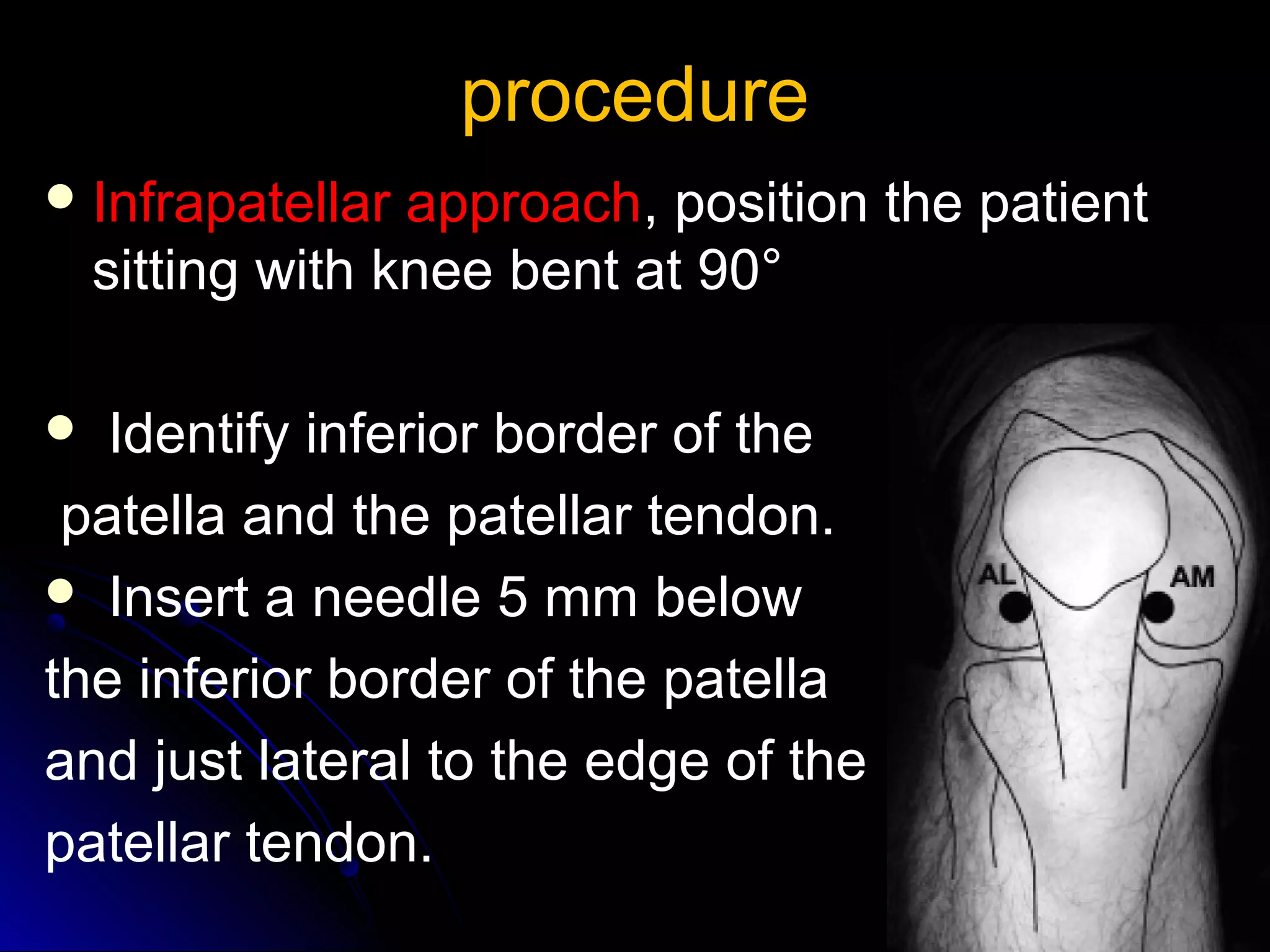 Knee arthrocentesis | PPT
