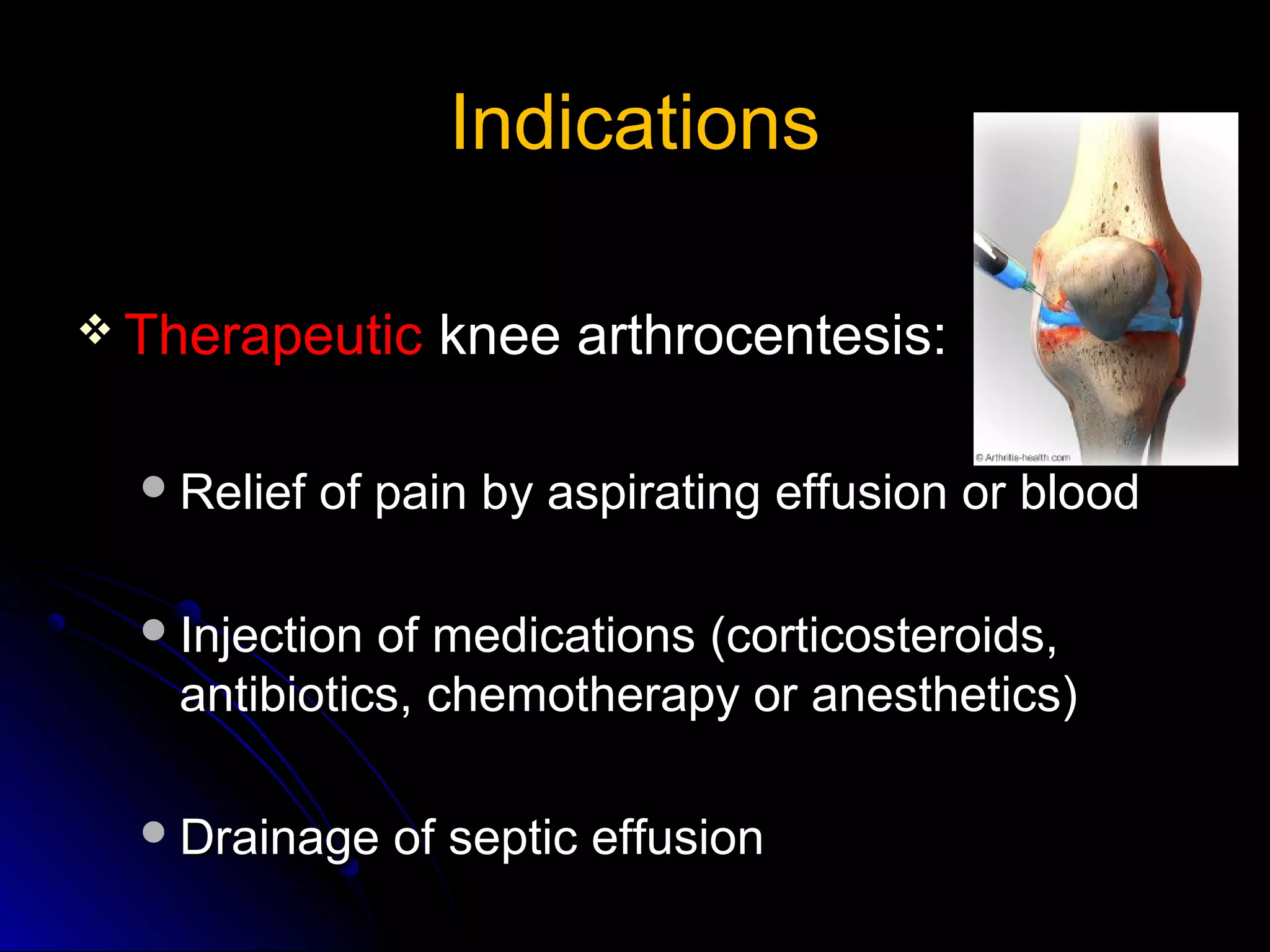 Knee arthrocentesis | PPT