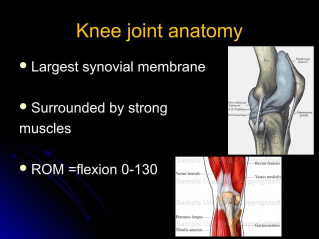 Knee arthrocentesis | PPT