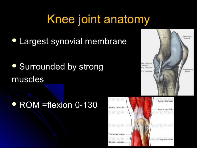 Knee arthrocentesis