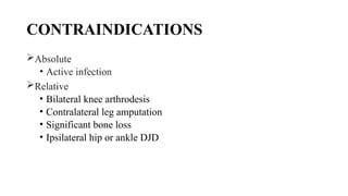 Knee Arthrodesis: Indications & Outcomes.pptx
