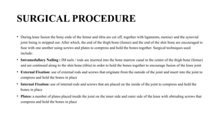 Knee Arthrodesis: Indications & Outcomes.pptx