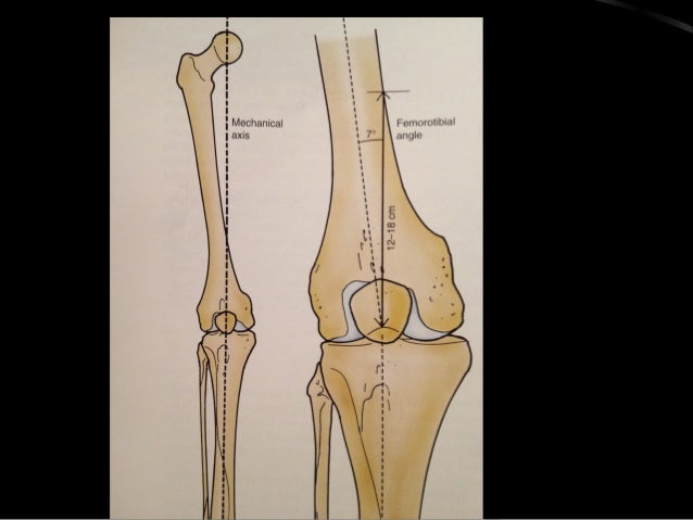 Knee arthroplasty for FRCS Orth course Newcastle