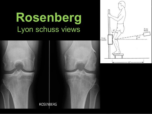Knee arthroplasty for FRCS Orth course Newcastle