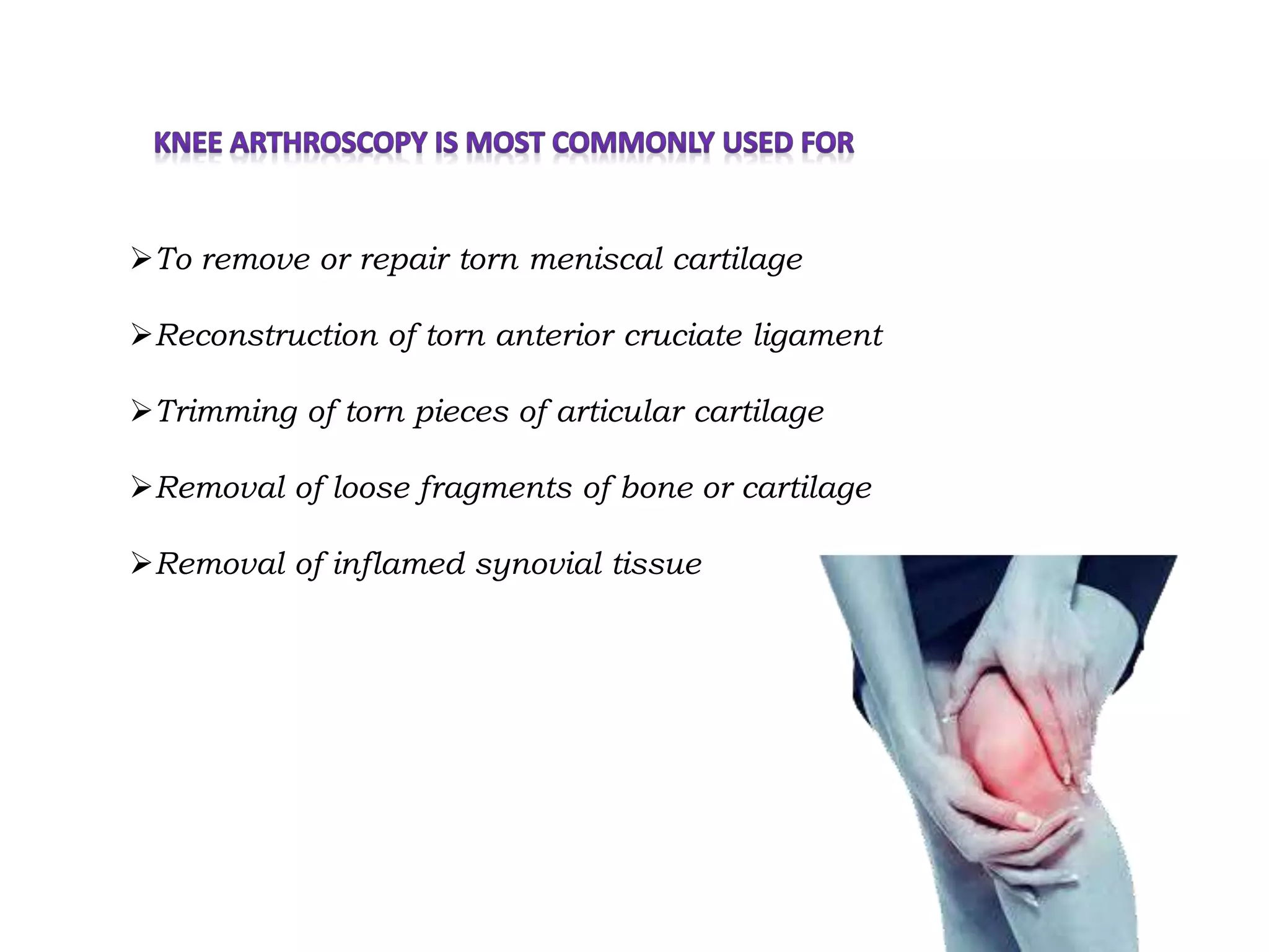 Knee Arthroscopic Surgery | PPTX