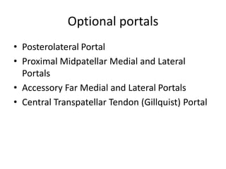 Knee arthroscopy portals | PPTX