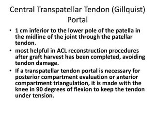 Knee arthroscopy portals | PPTX