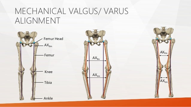 Knee biomechanics dr.bhuvanesh