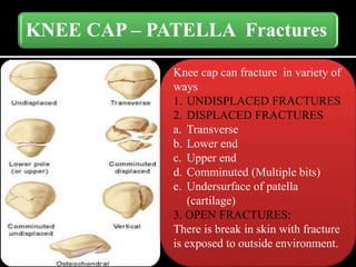Patella Fracture Classification
