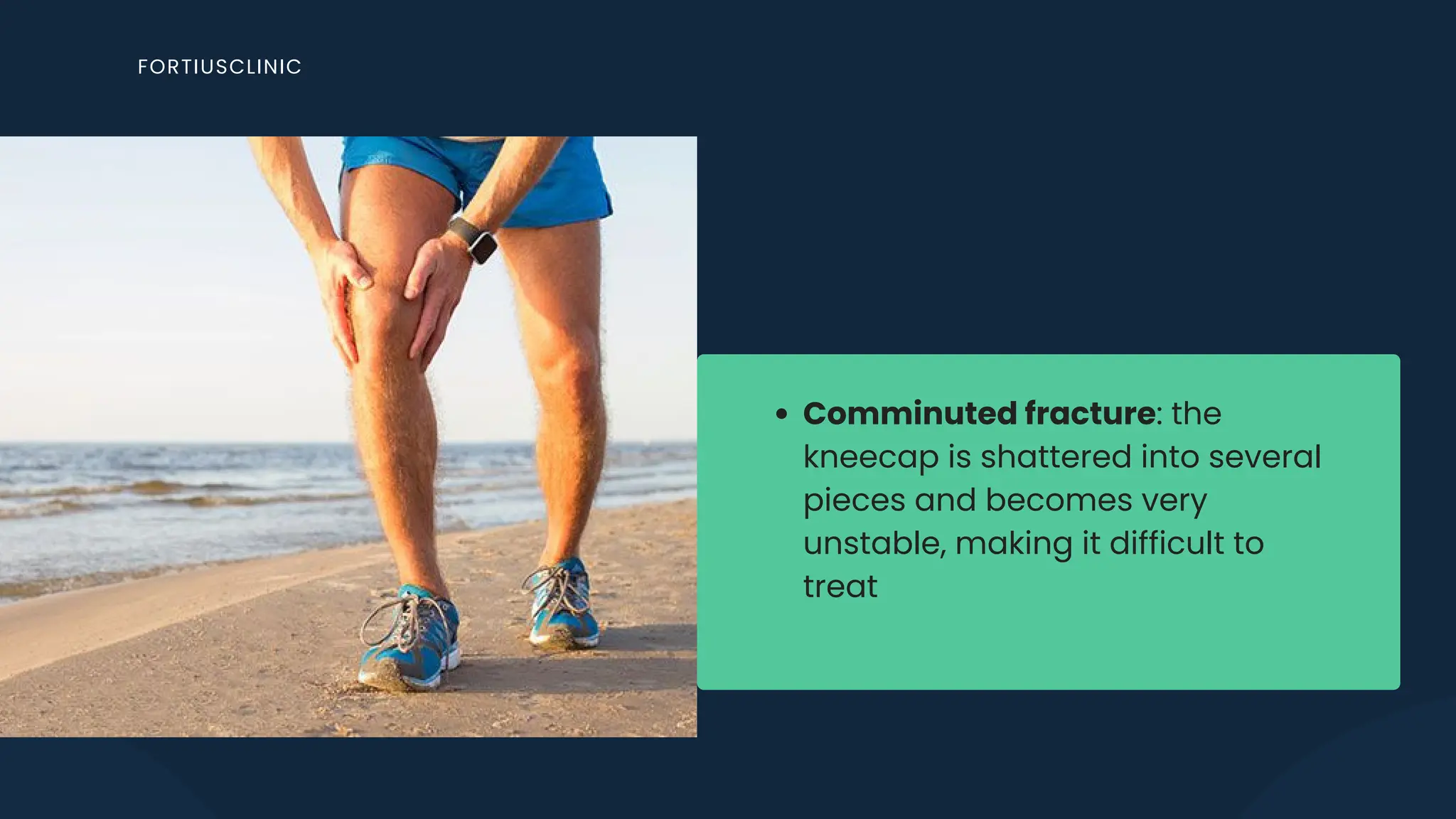 Four types of knee cap (patella) fracture | PDF