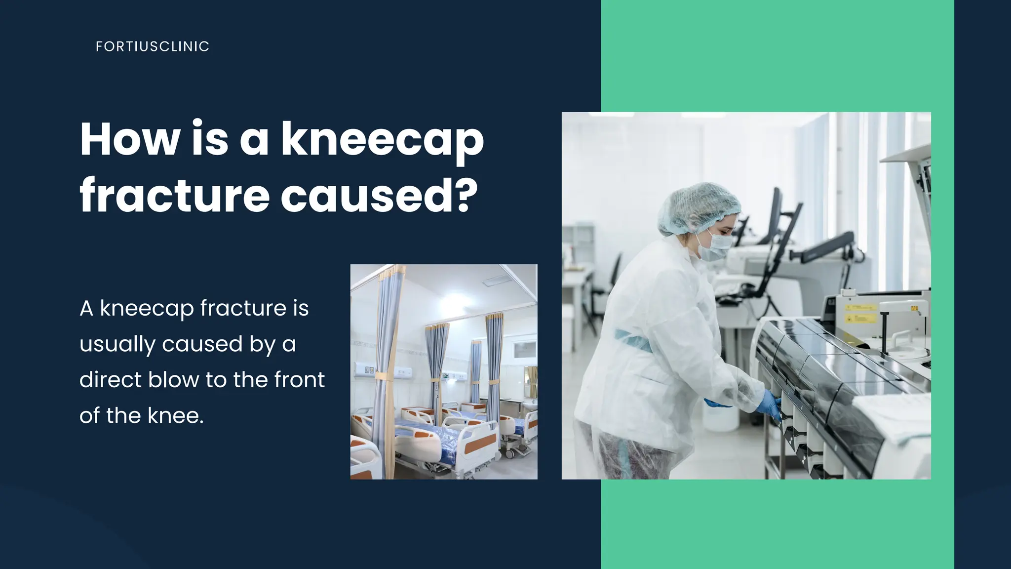 Four types of knee cap (patella) fracture | PDF