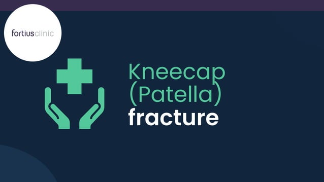 Four types of knee cap (patella) fracture | PPT