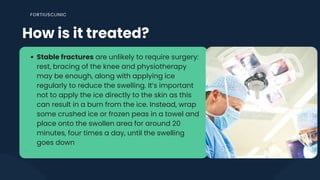 Four types of knee cap (patella) fracture | PDF