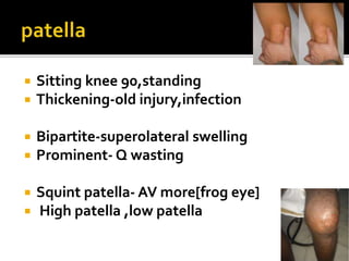 Frog Eyed Patella