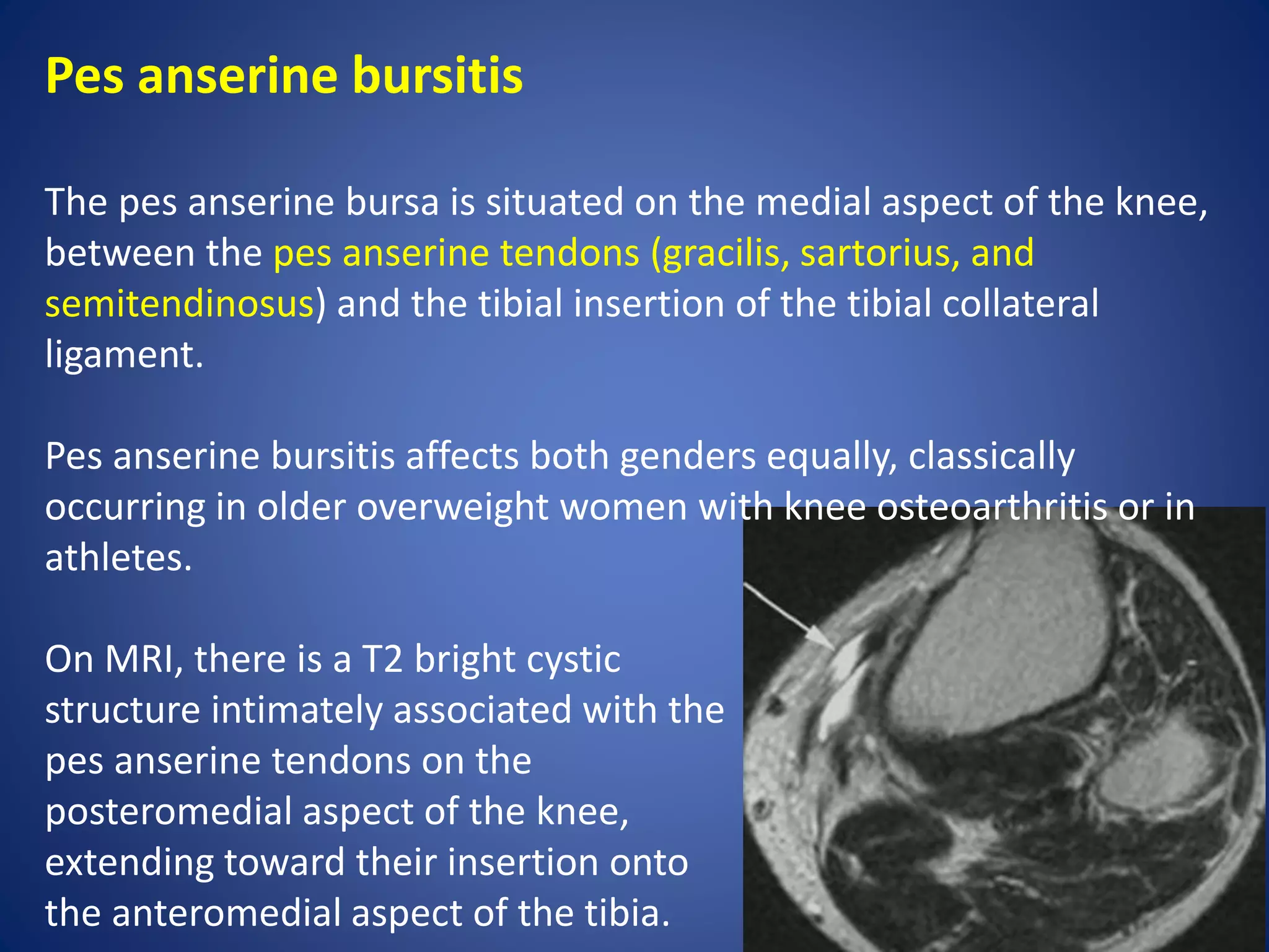 Knee cystic lesions | PPTX