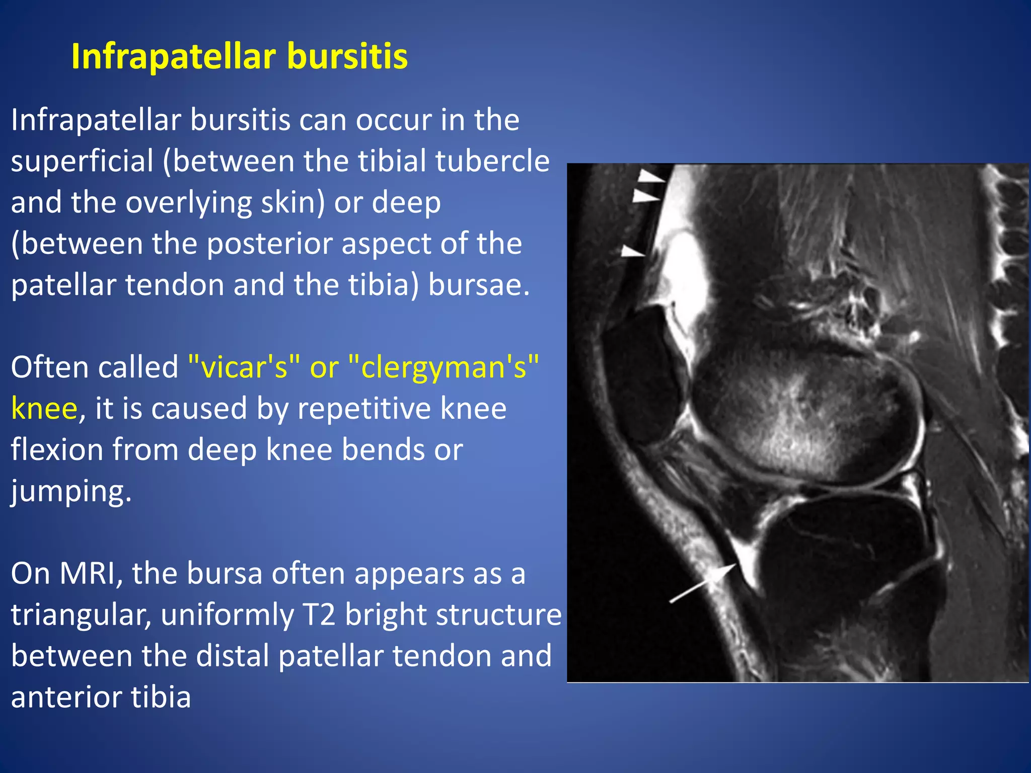 Knee cystic lesions | PPTX