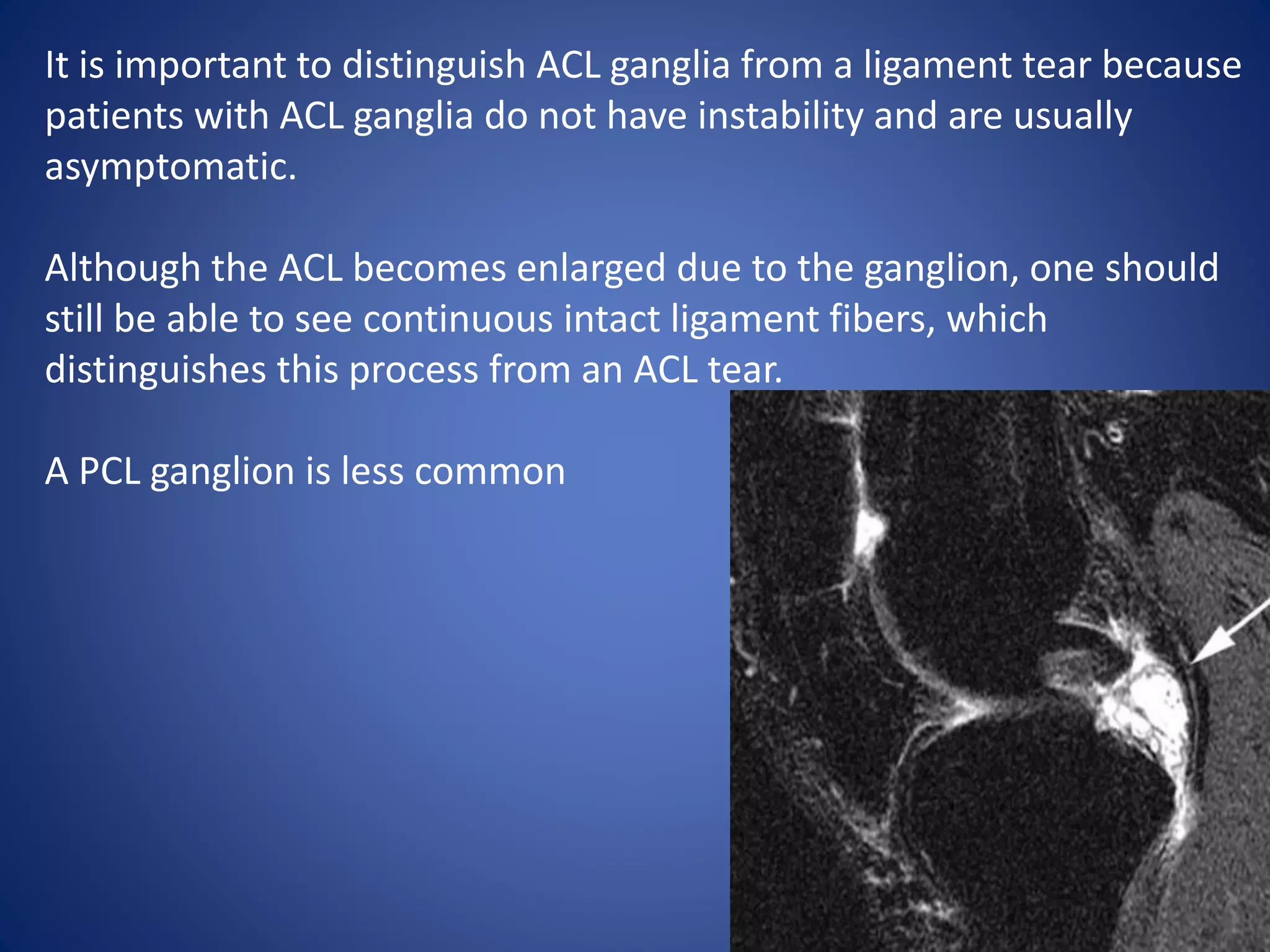 Knee cystic lesions | PPTX