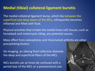 Knee cystic lesions | PPTX