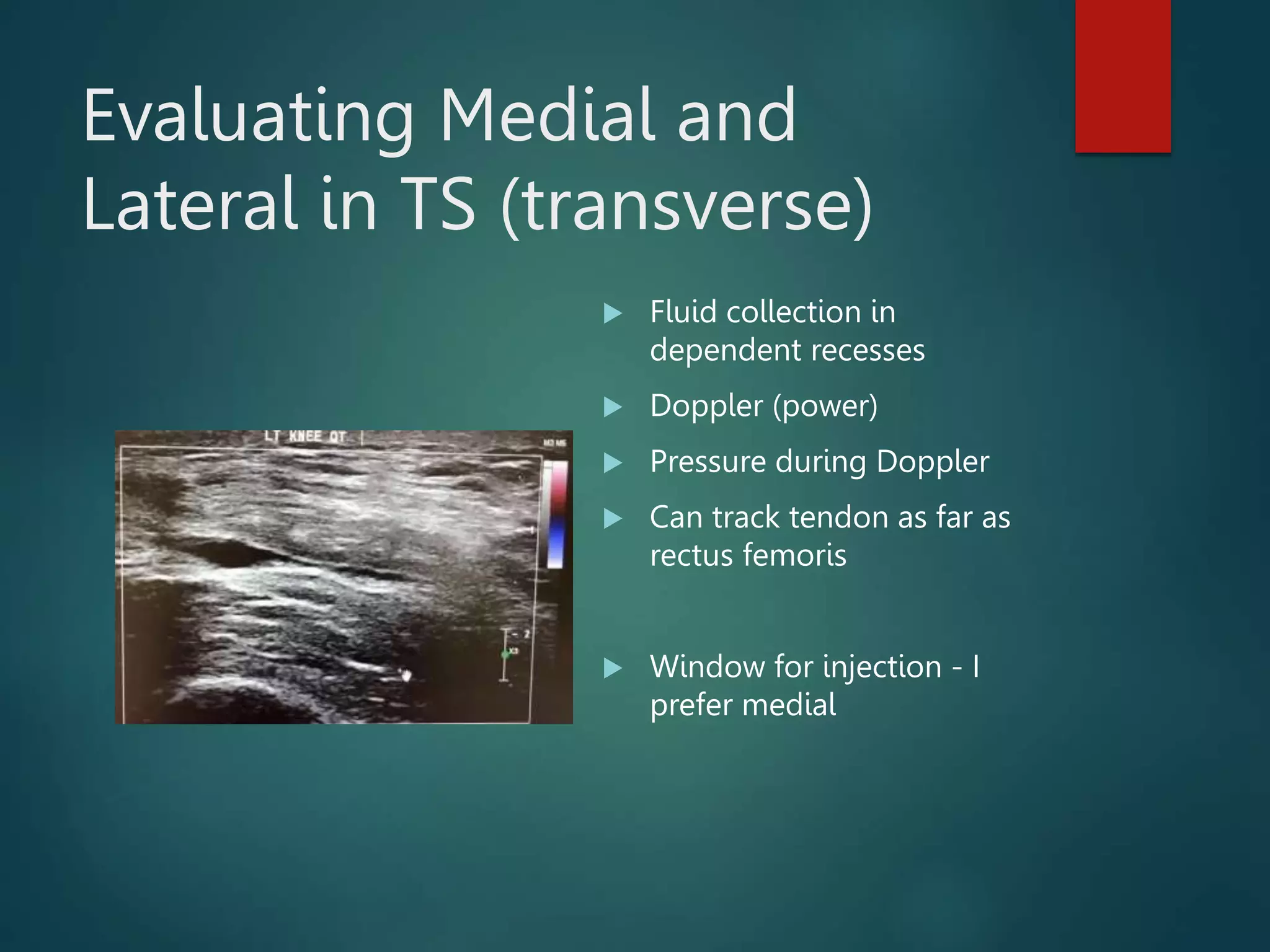Knee Diagnostic MSK Ultrasound.pptx