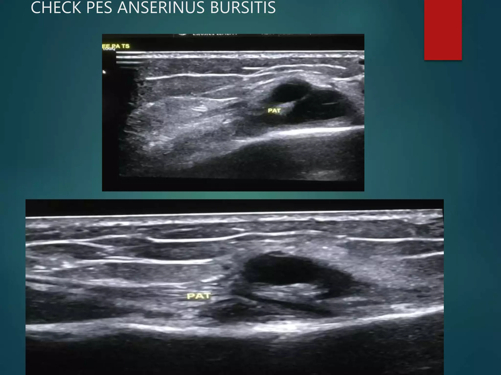 Knee Diagnostic MSK Ultrasound.pptx