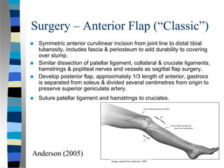 Knee_Disarticulation.pdf fully described and explained | PPT